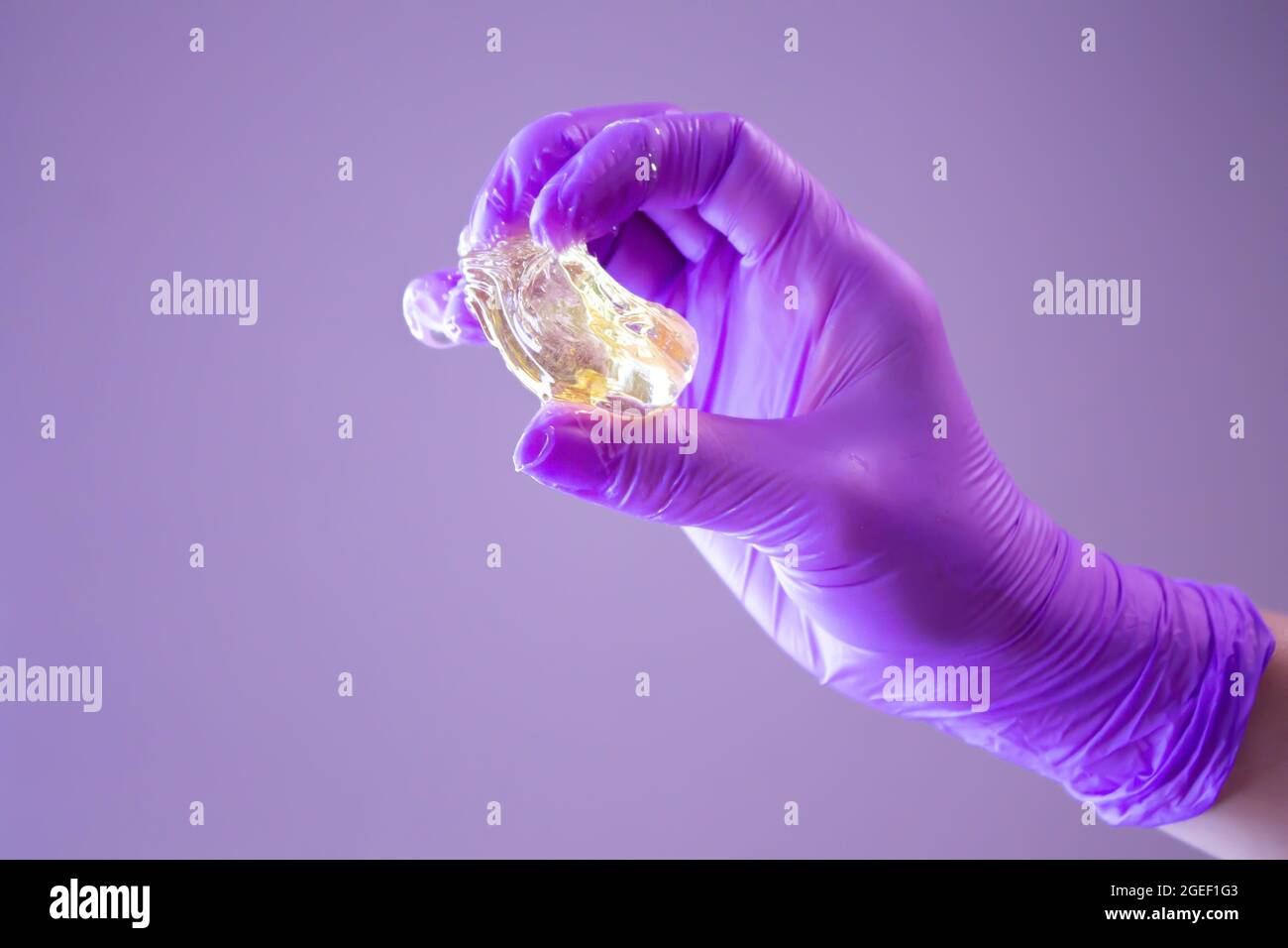 Liquid sugar for sugaring. Depilation and epilation with hot sugar. A ...