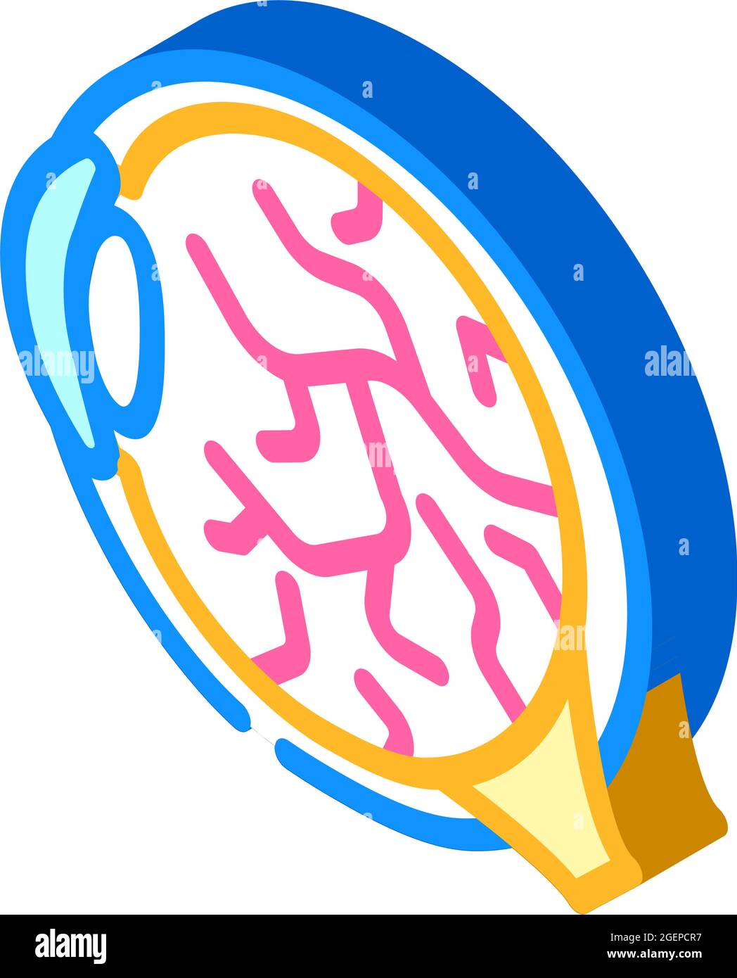 inflammation of eye ophthalmology isometric icon vector illustration ...