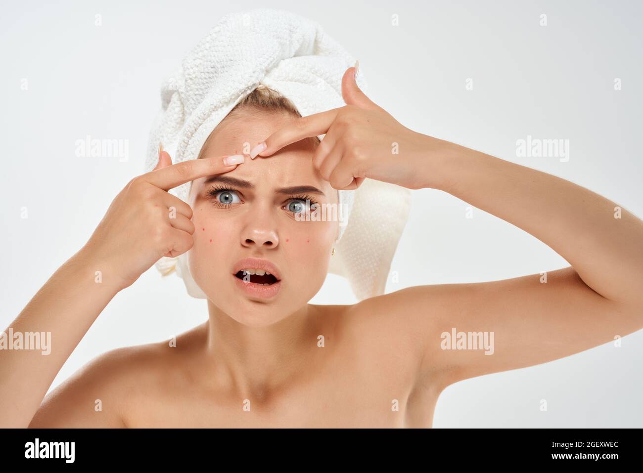 pretty woman with a towel on her head squeezes out pimples on her face ...