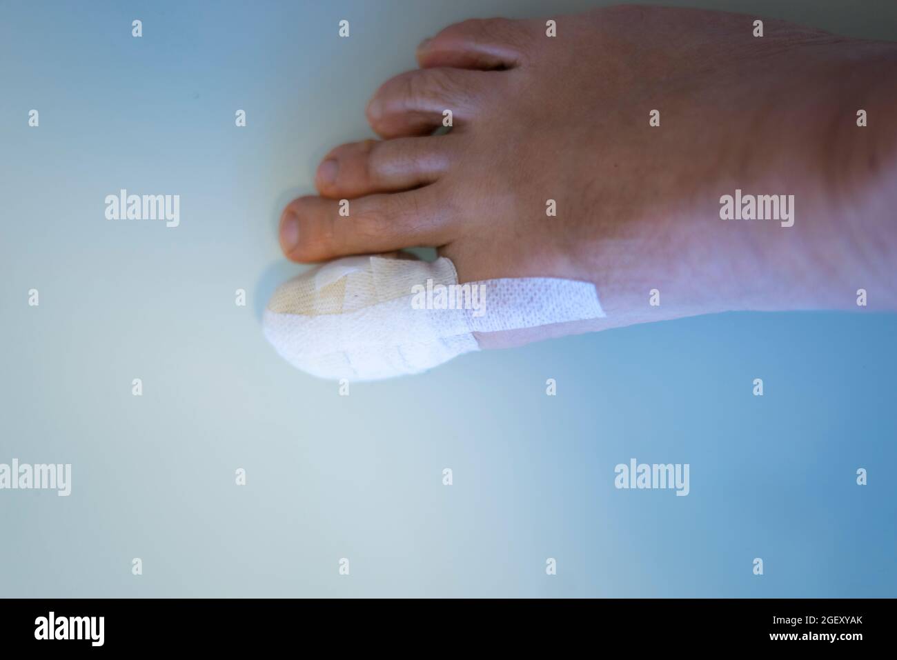 Foot big toe bandage injured feet in medical clinic hospital center ...
