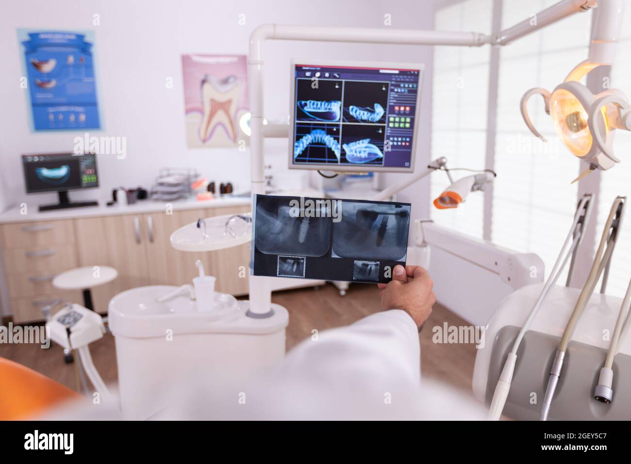 Radiologist man doctor comparing medical teeth radiography expertise ...