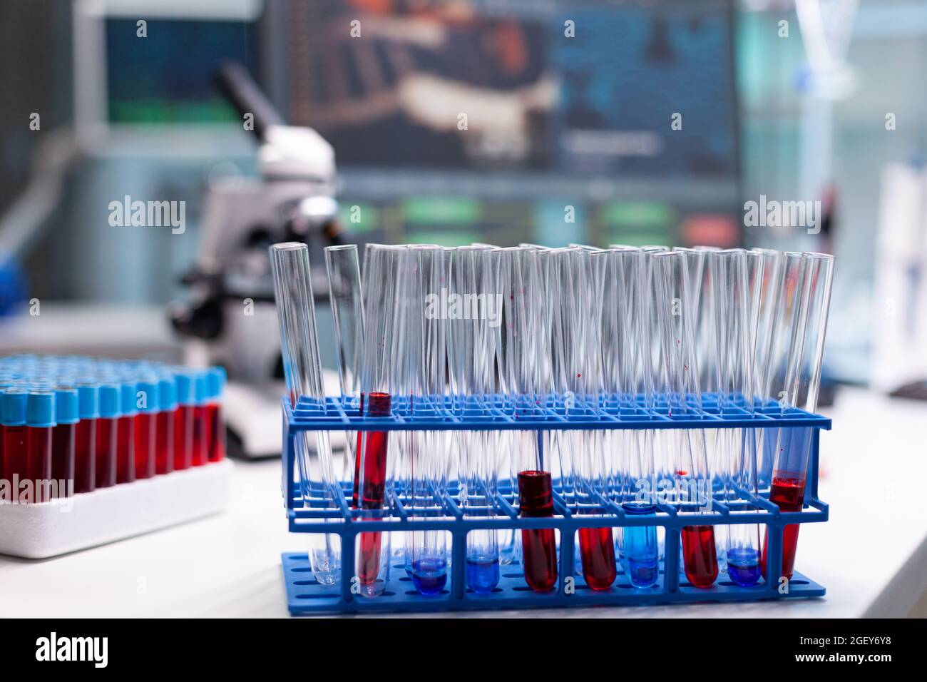 Medical test tube with blood sample standing on table during ...