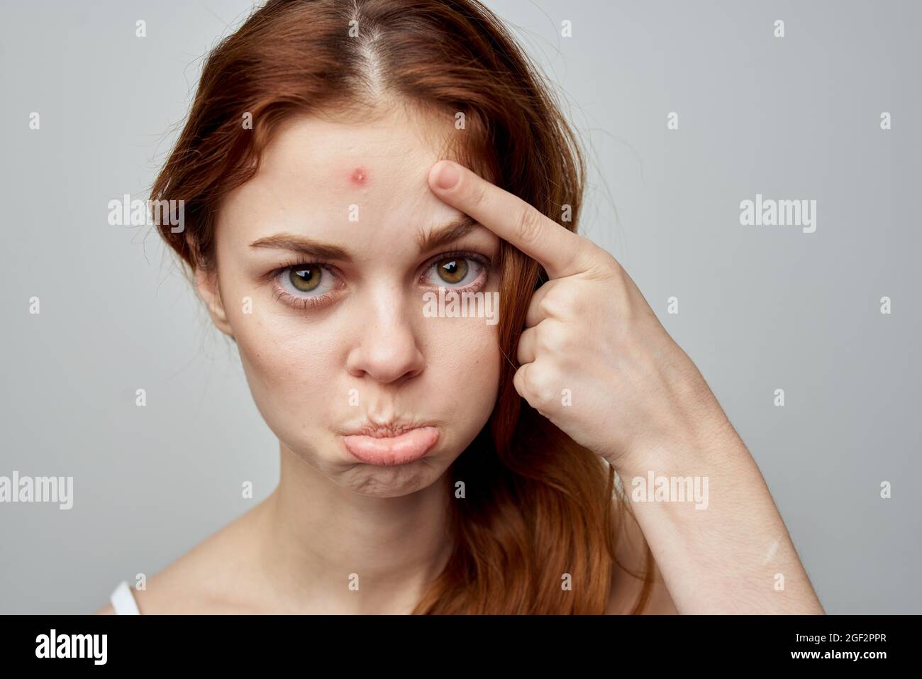 pretty woman skin problems cosmetology Studio Stock Photo - Alamy