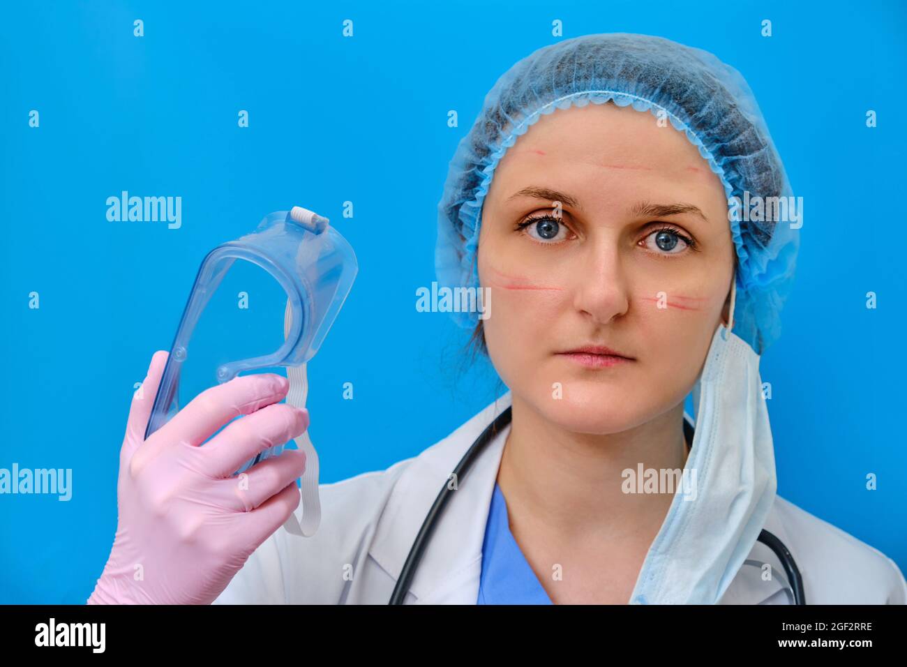 A doctor with a wounded face removes goggles after working in the ...