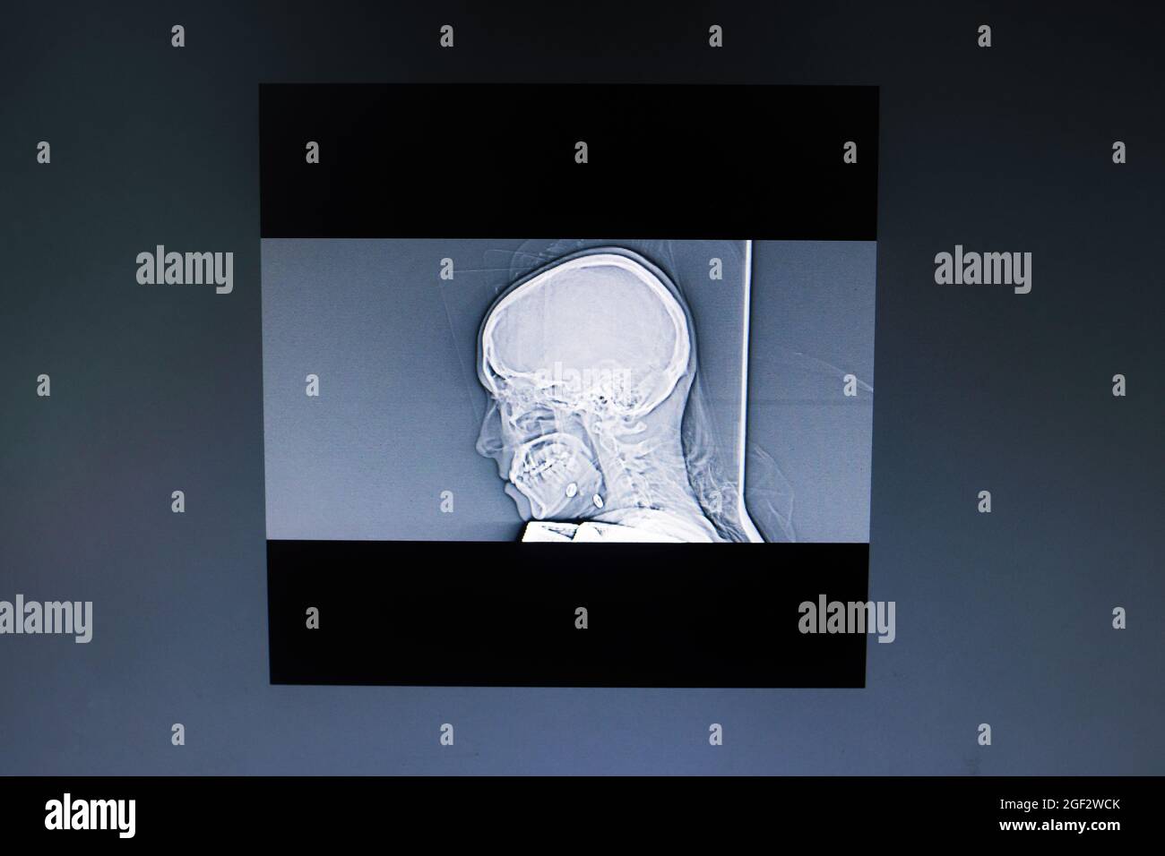 Image of computed tomography of the brain close up Stock Photo - Alamy