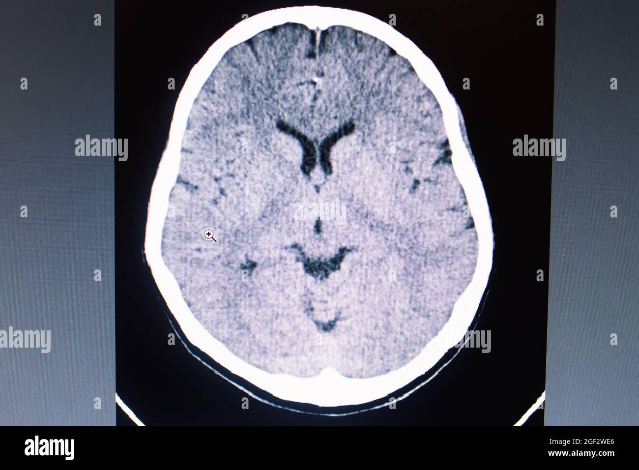Image of computed tomography of the brain close up Stock Photo - Alamy