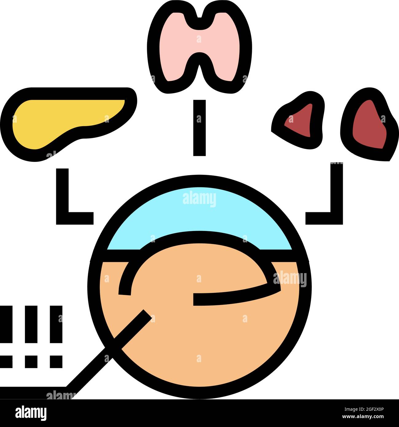 multiple endocrine neoplasia endocrinology color icon vector ...