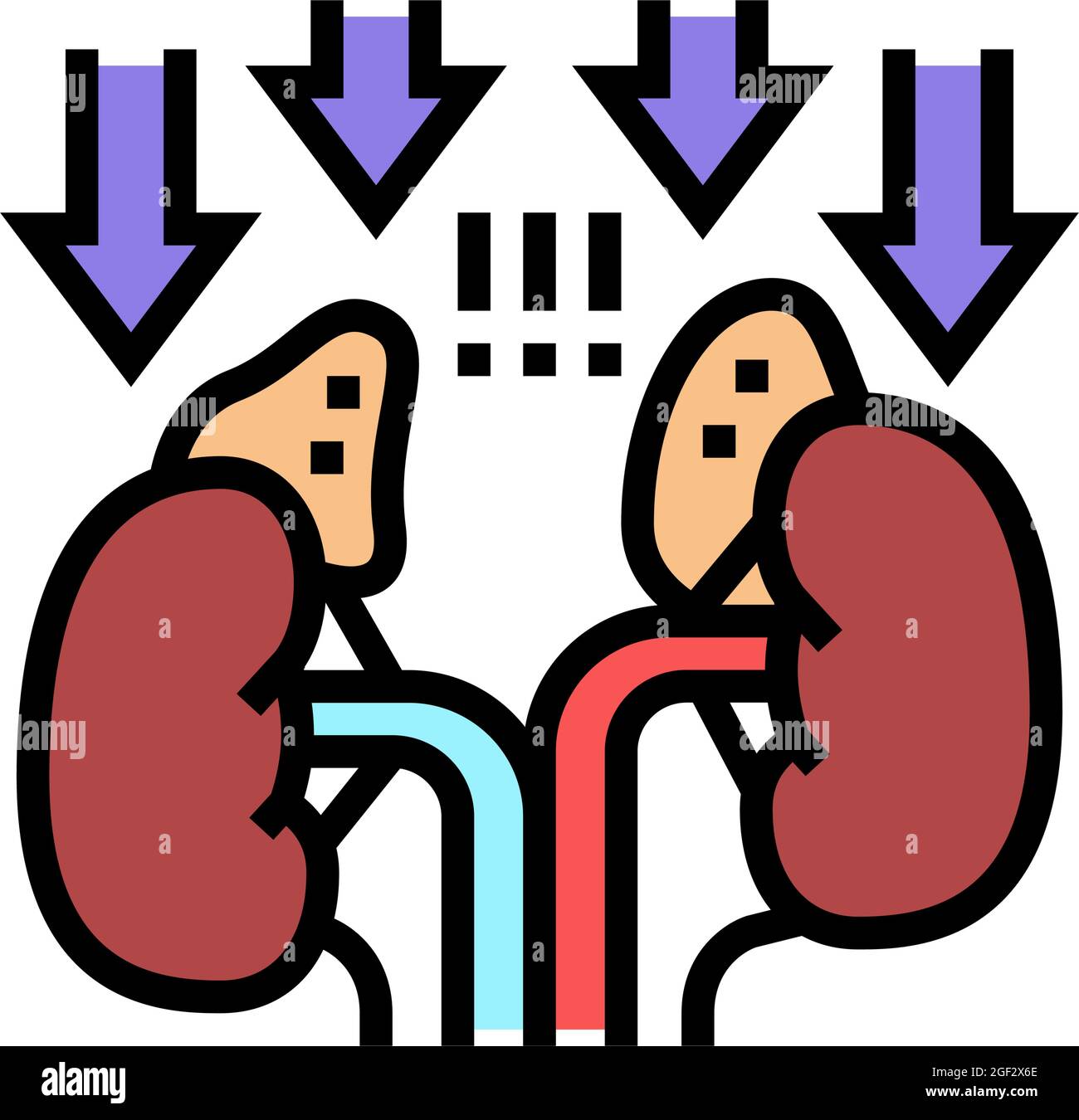 adrenal insufficiency endocrinology color icon vector illustration ...