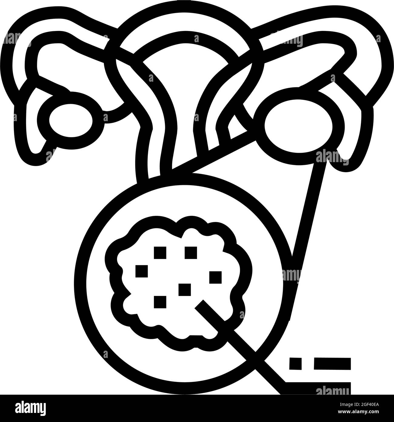 polycystic ovary syndrome endocrinology line icon vector illustration ...