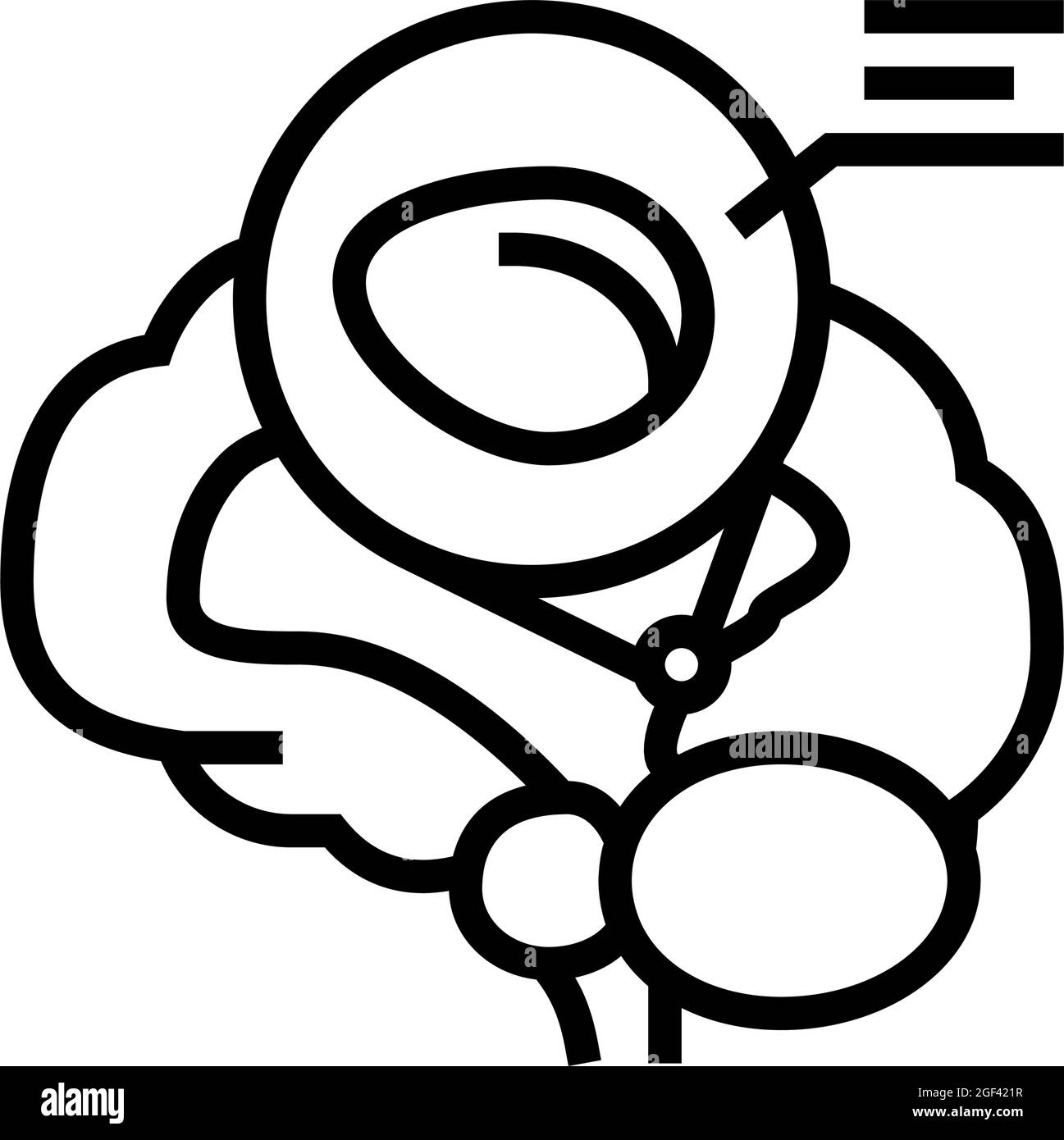 'pituitary gland' Black and White Stock Photos & Images - Alamy