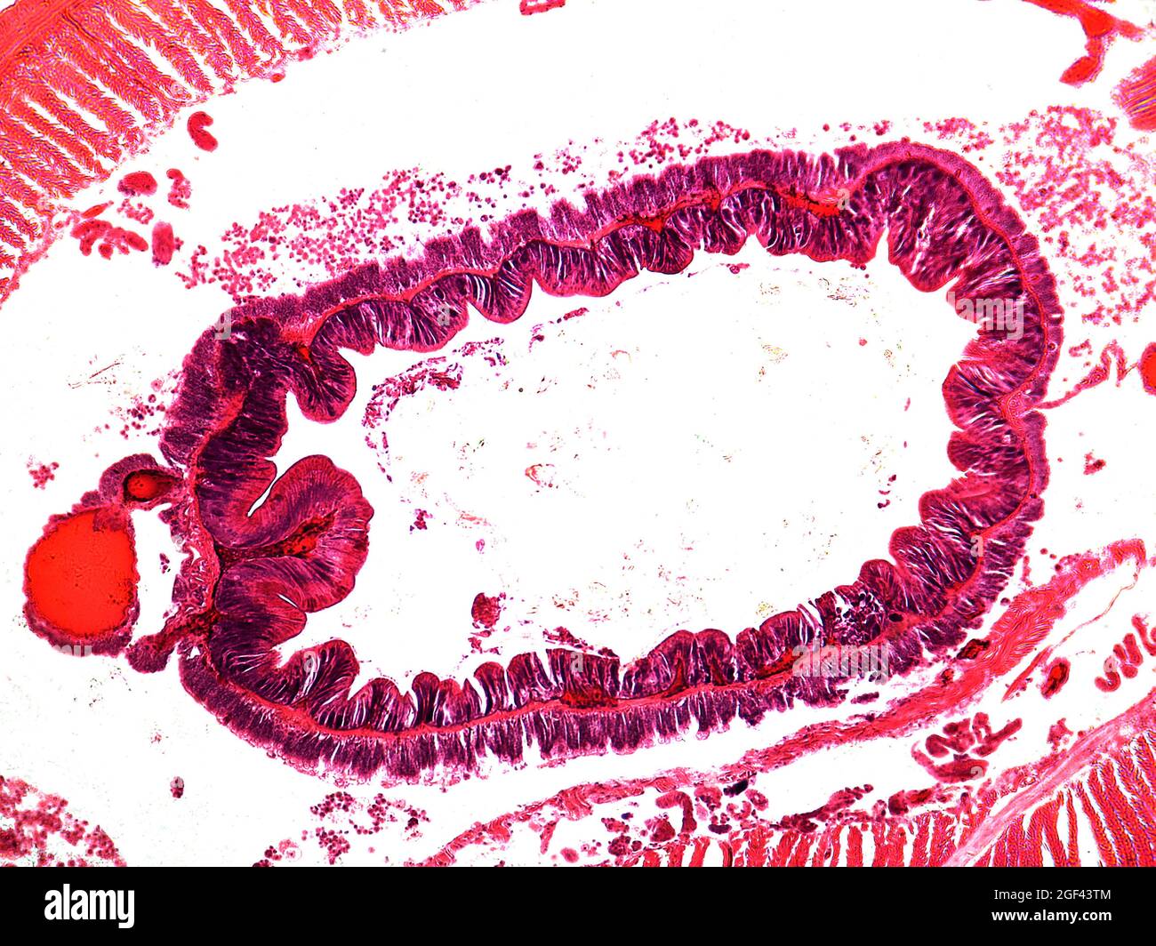 Earthworm Cross Section Under Microscope