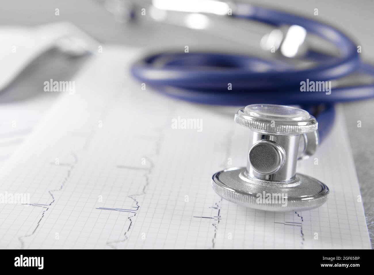 Cardiogram chart with medical stethoscope on table closeup Stock Photo ...