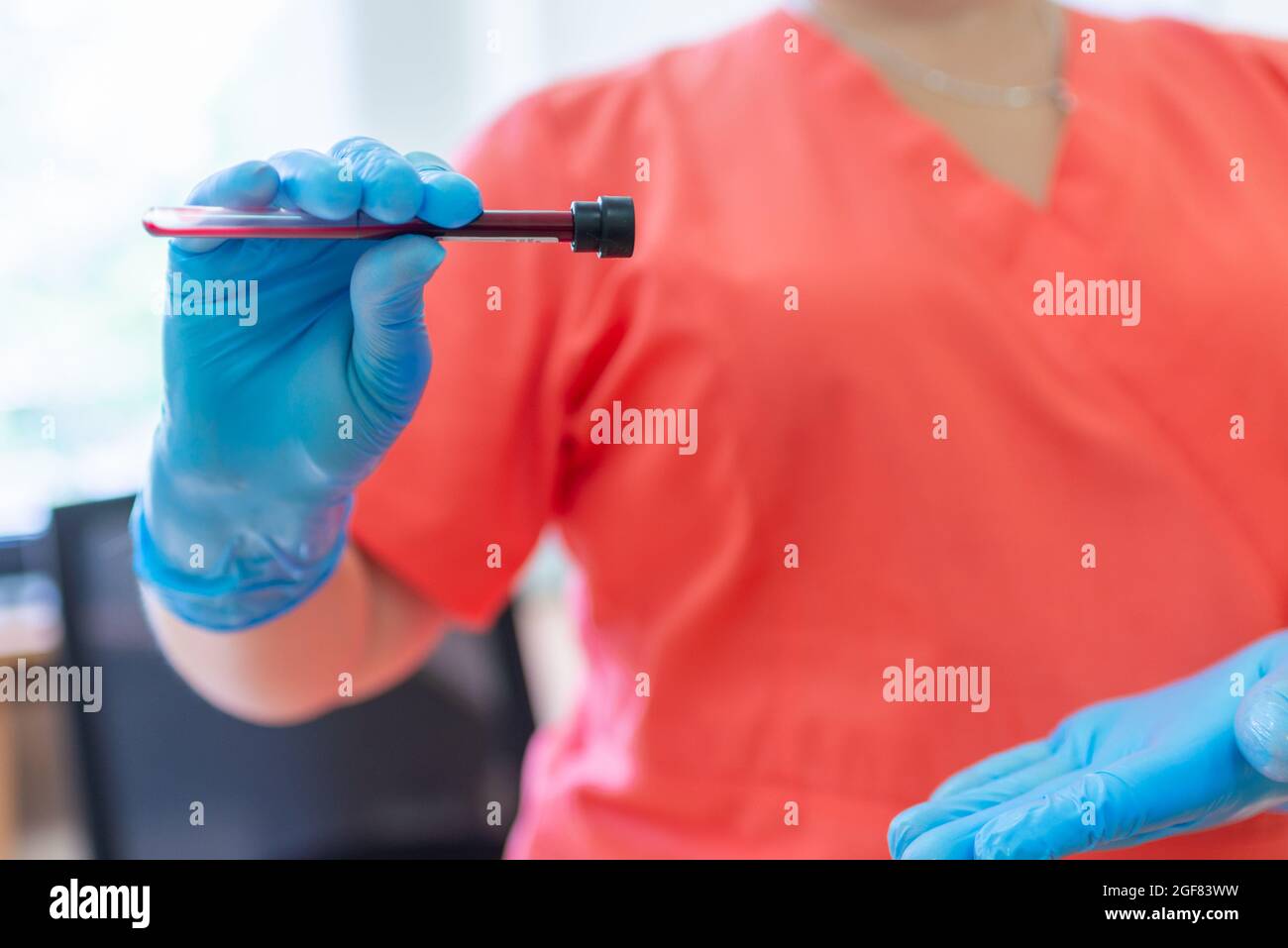 Female nurse holds test tube with a blood sample with positive test ...
