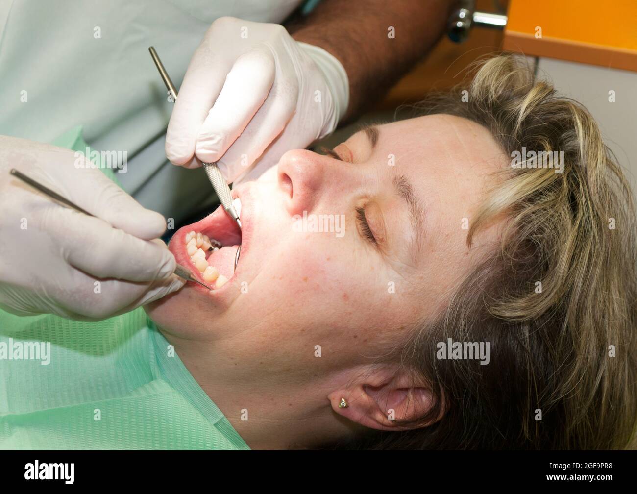 Woman in prophylaxis dental treatment Stock Photo - Alamy