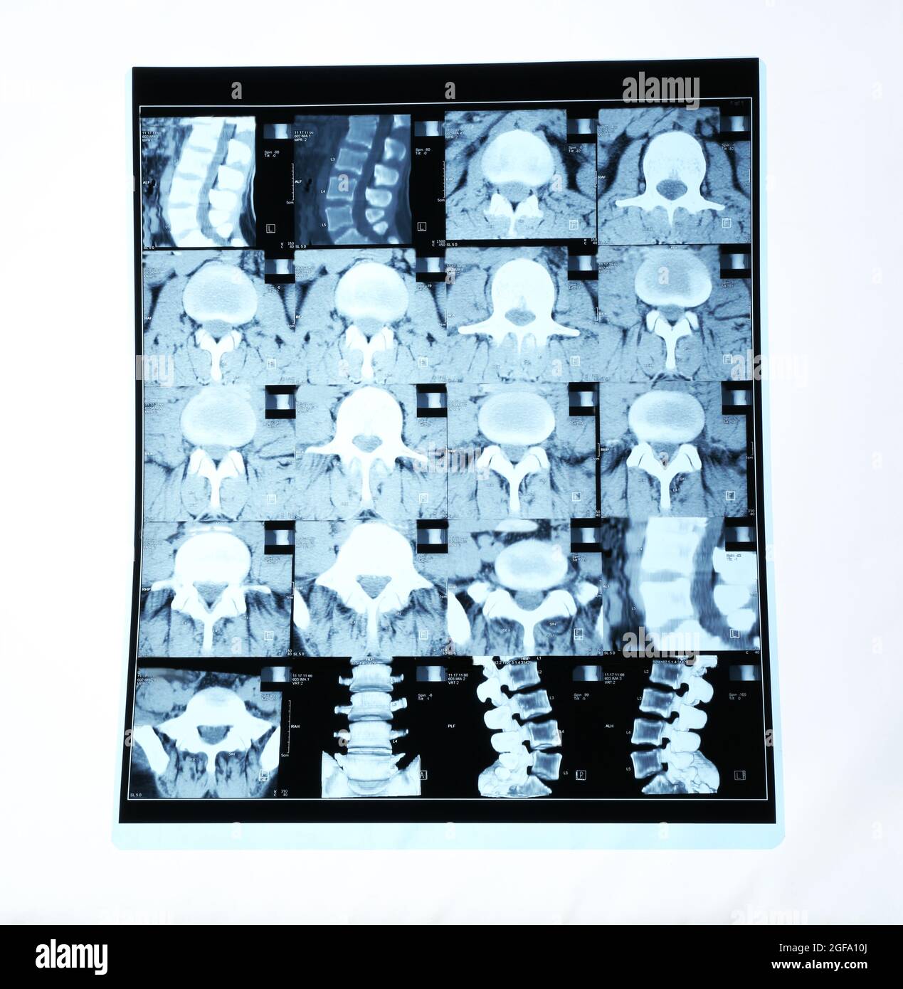 Collage of x-rays isolated on white Stock Photo - Alamy