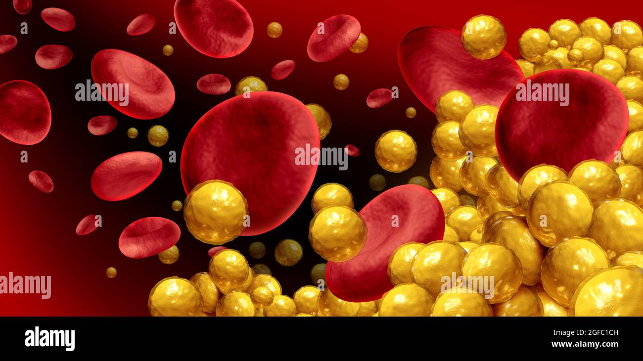 Blocked artery concept and human blood vessel as a disease with ...
