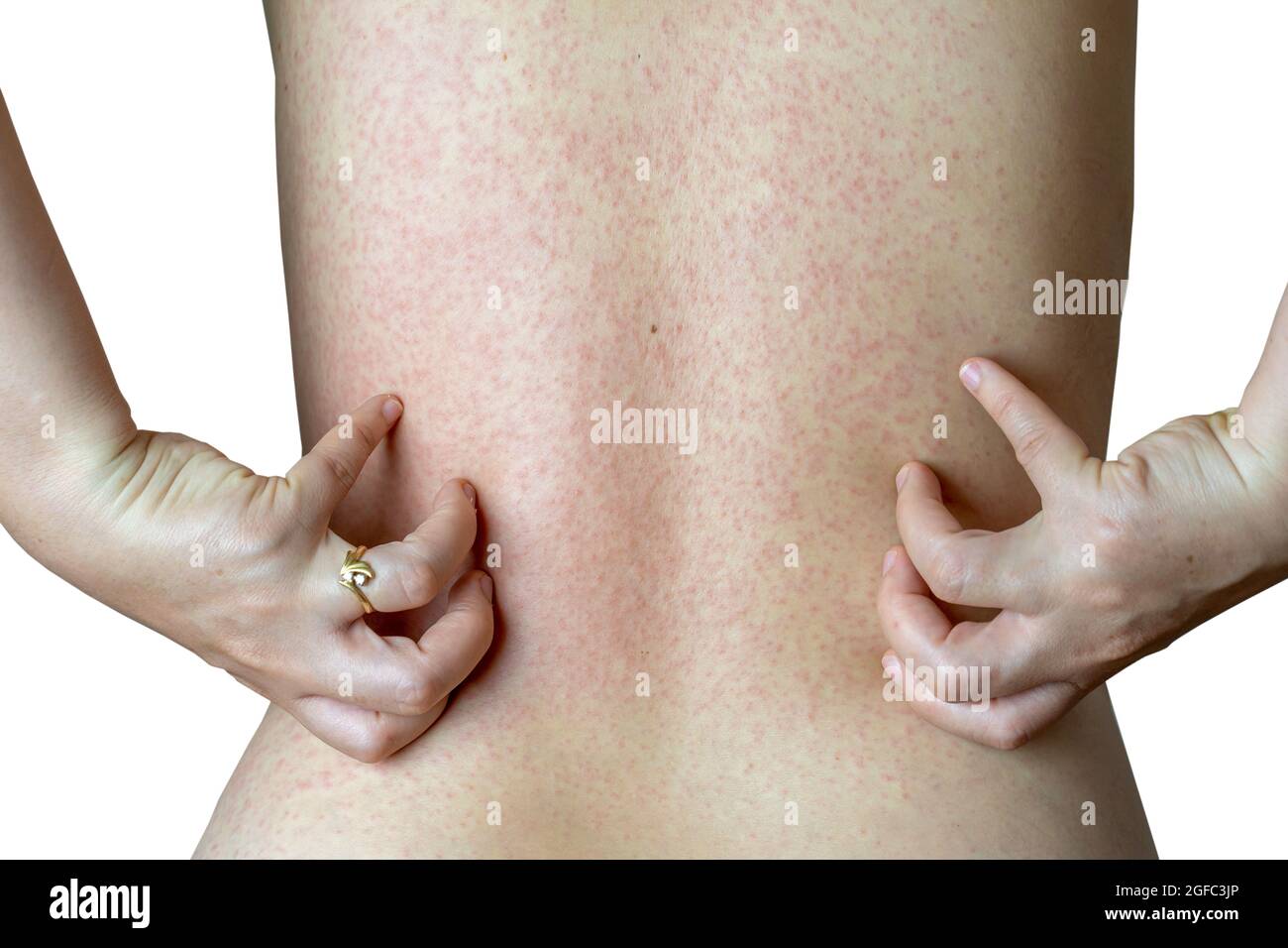 Woman scratching her back hi-res stock photography and images - Alamy