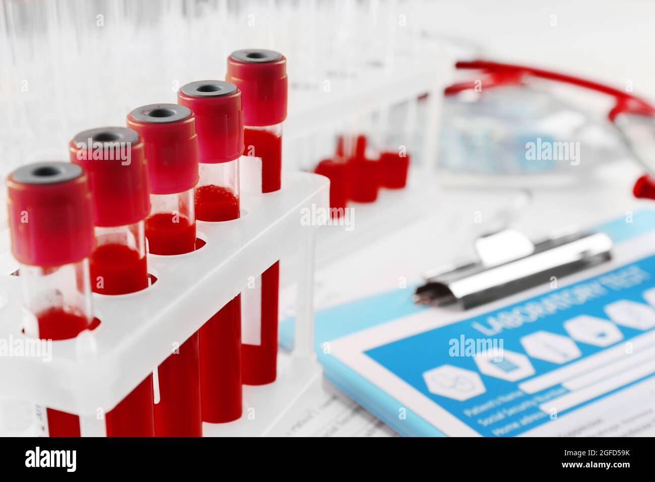 Blood samples, close up Stock Photo - Alamy