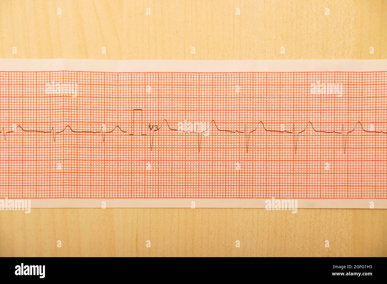 Ecg test hi-res stock photography and images - Alamy