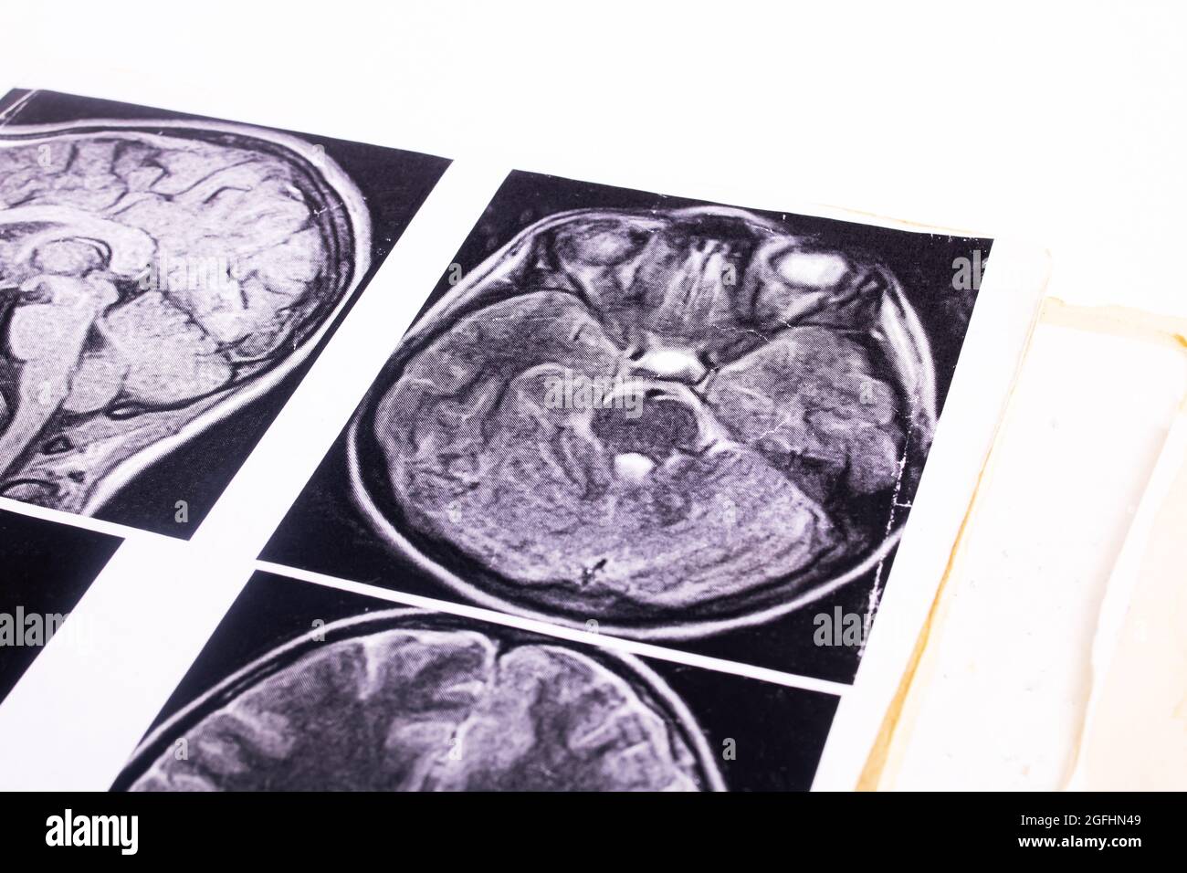 MRI image of the brain on paper close up Stock Photo - Alamy