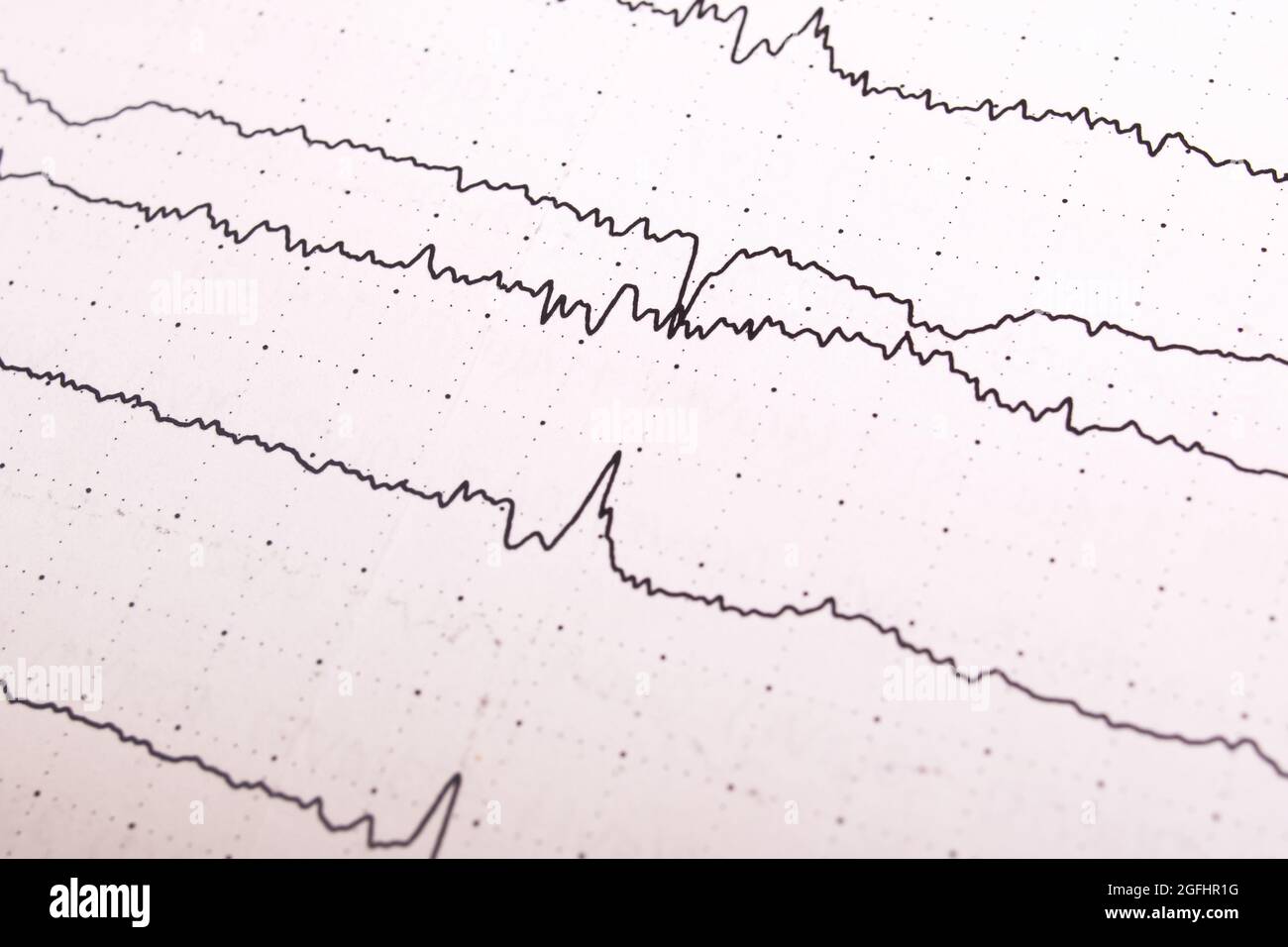Electroencephalogram hi-res stock photography and images - Alamy