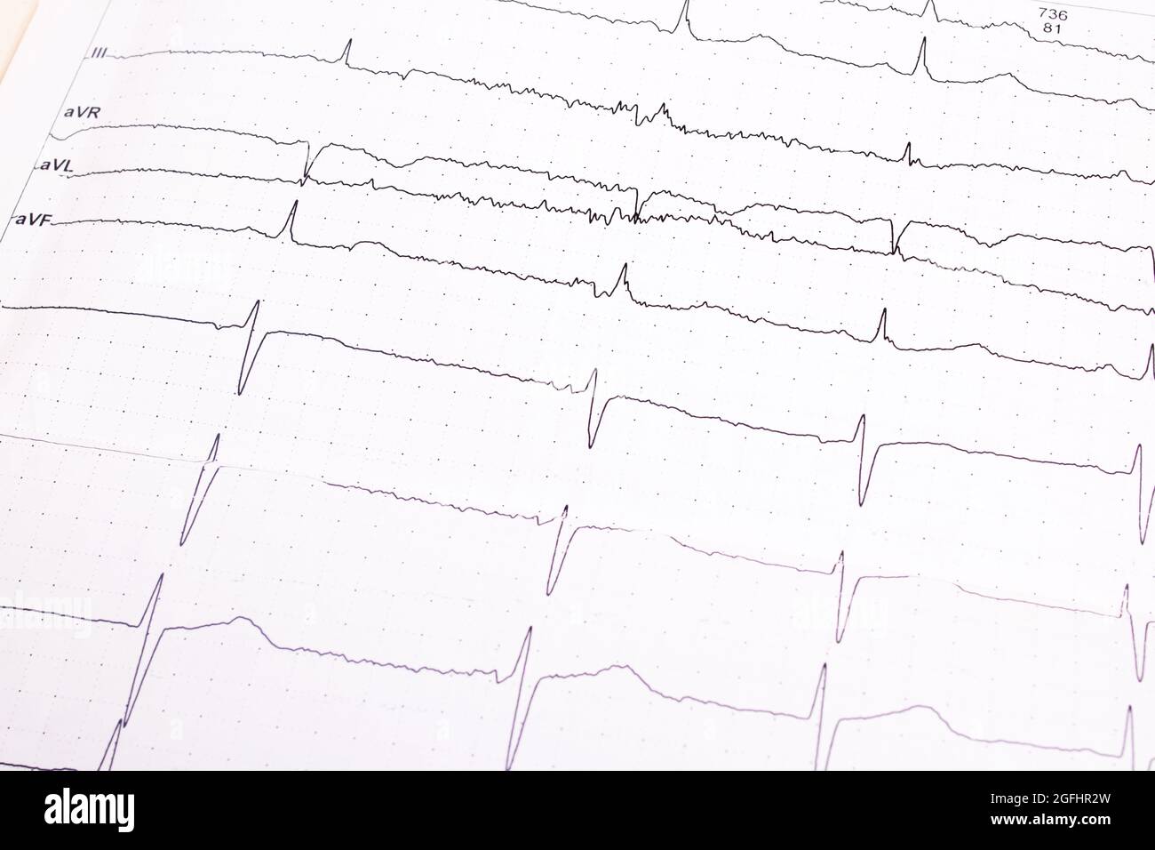 Electroencephalogram hi-res stock photography and images - Alamy