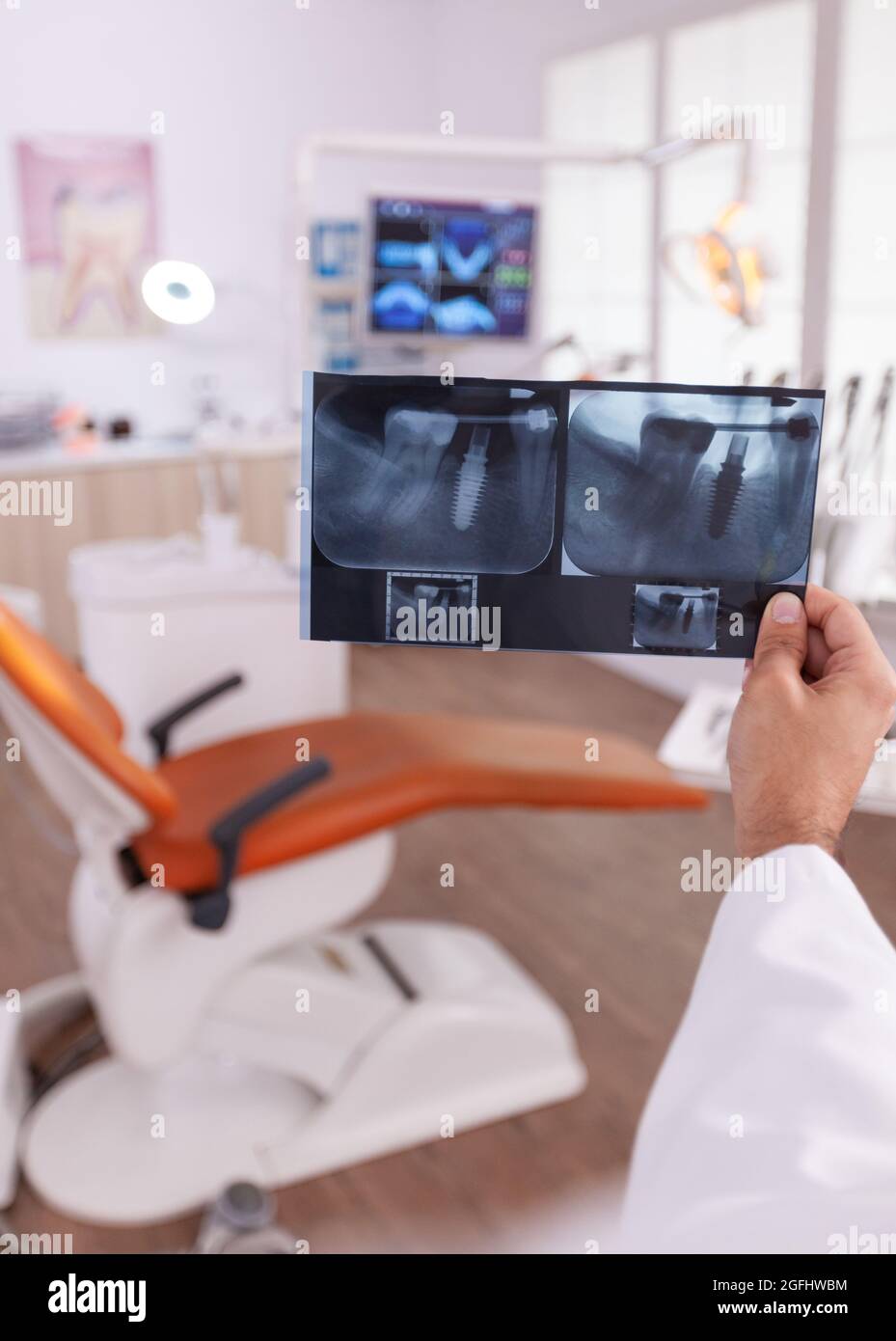 Specialist orthodontist doctor holding teeth surgery radiography ...