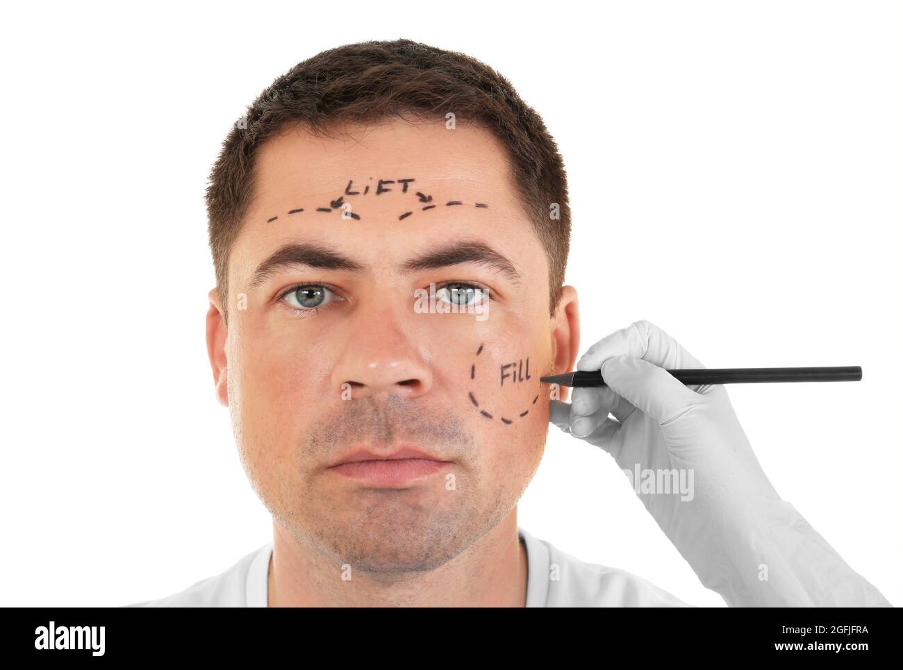 Plastic surgery concept. Hand in glove marking male face Stock Photo ...