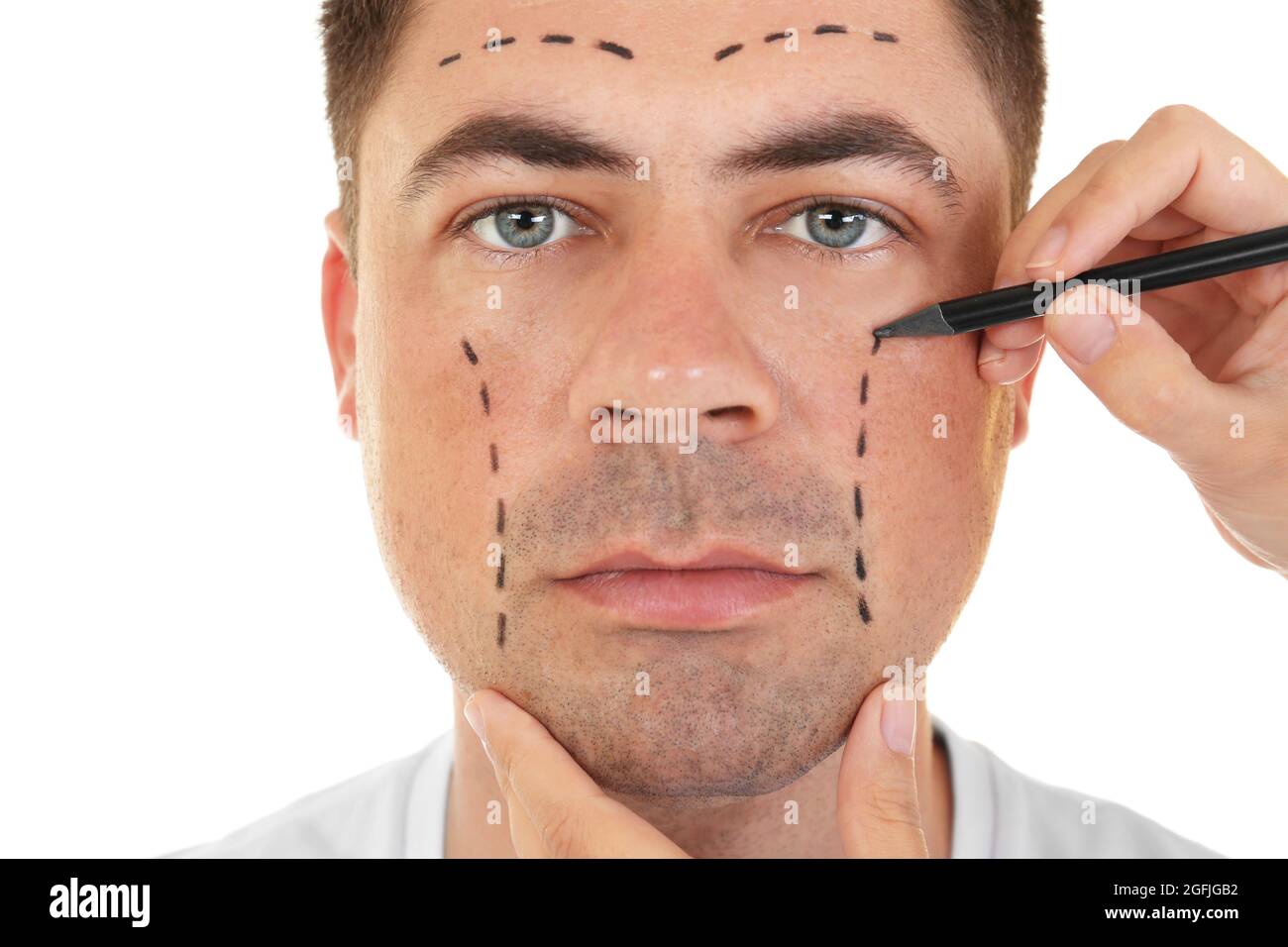 Plastic surgery concept. Hands marking male face Stock Photo - Alamy