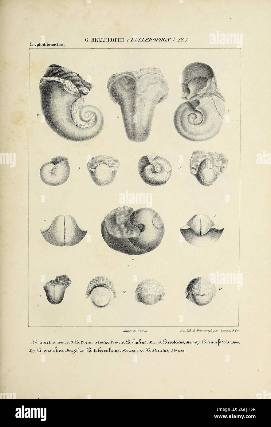 Acetabular shell hi-res stock photography and images - Alamy