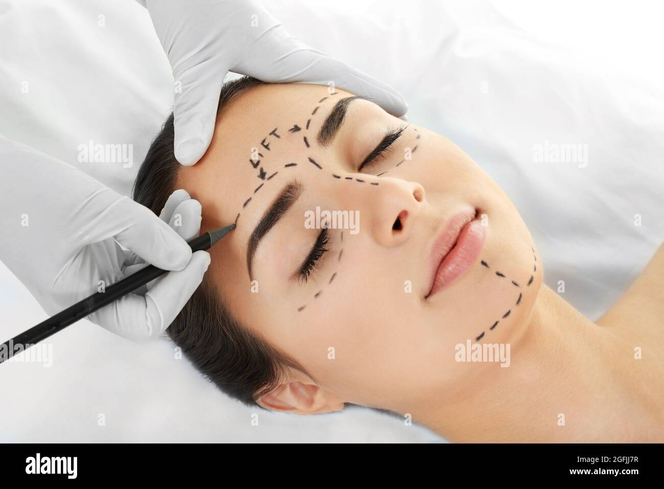 Plastic surgery concept. Hands in gloves marking women face Stock Photo ...