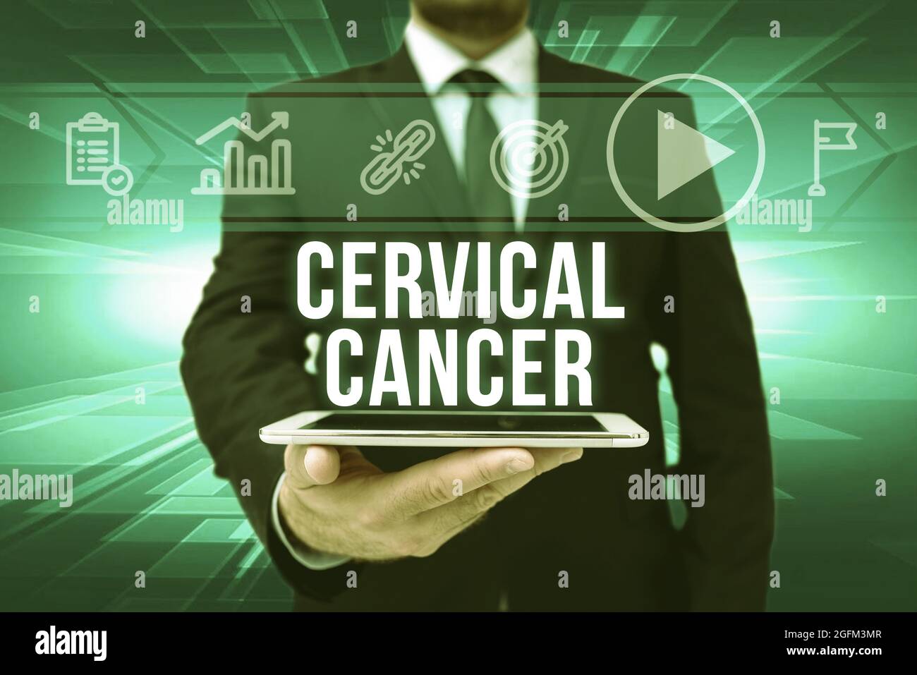 Sign displaying Cervical Cancer. Concept meaning type of cancer that ...