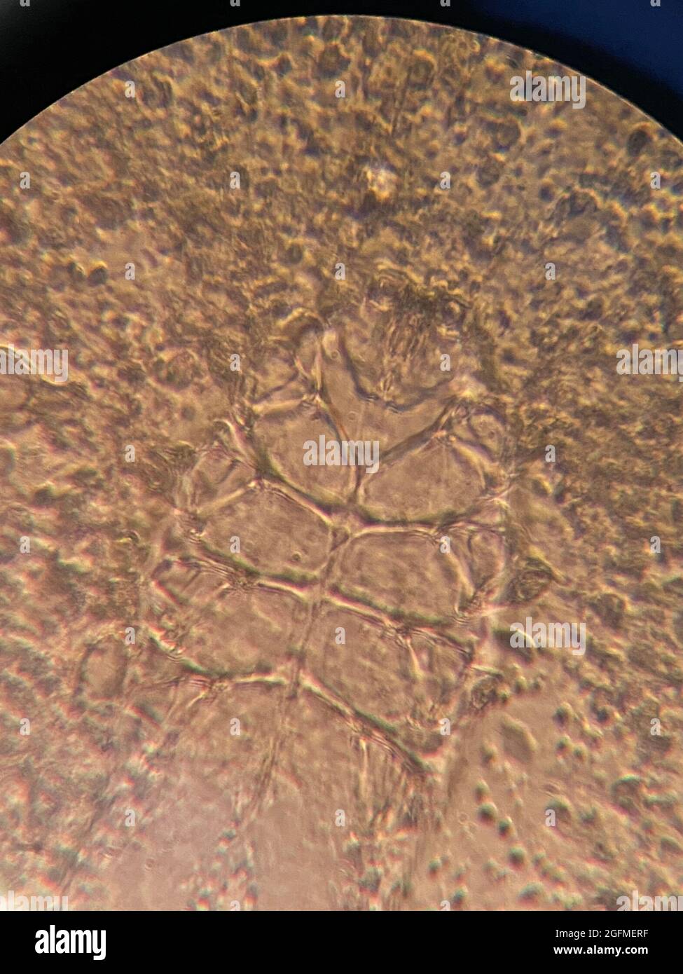 Histology hair hi-res stock photography and images - Alamy