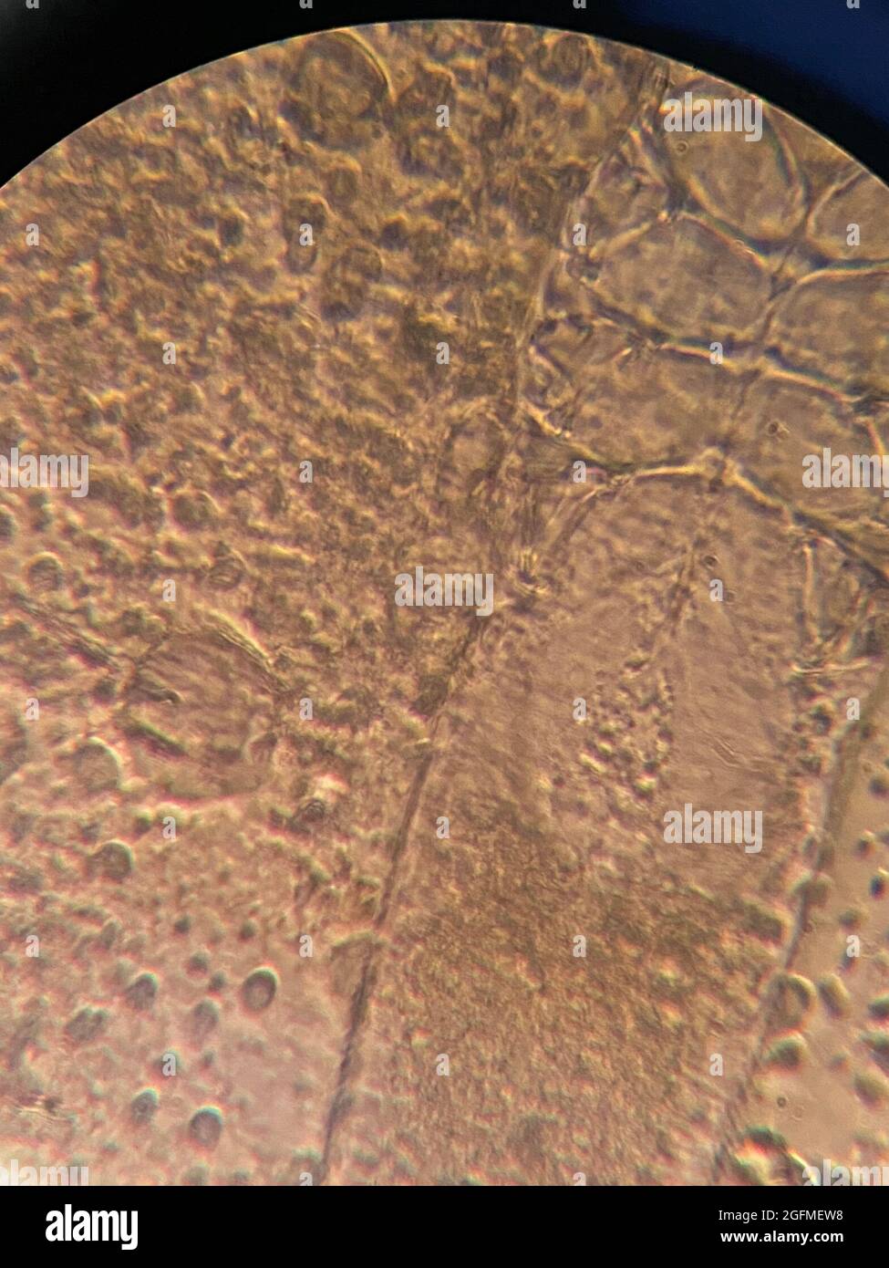 Histology hair hi-res stock photography and images - Alamy