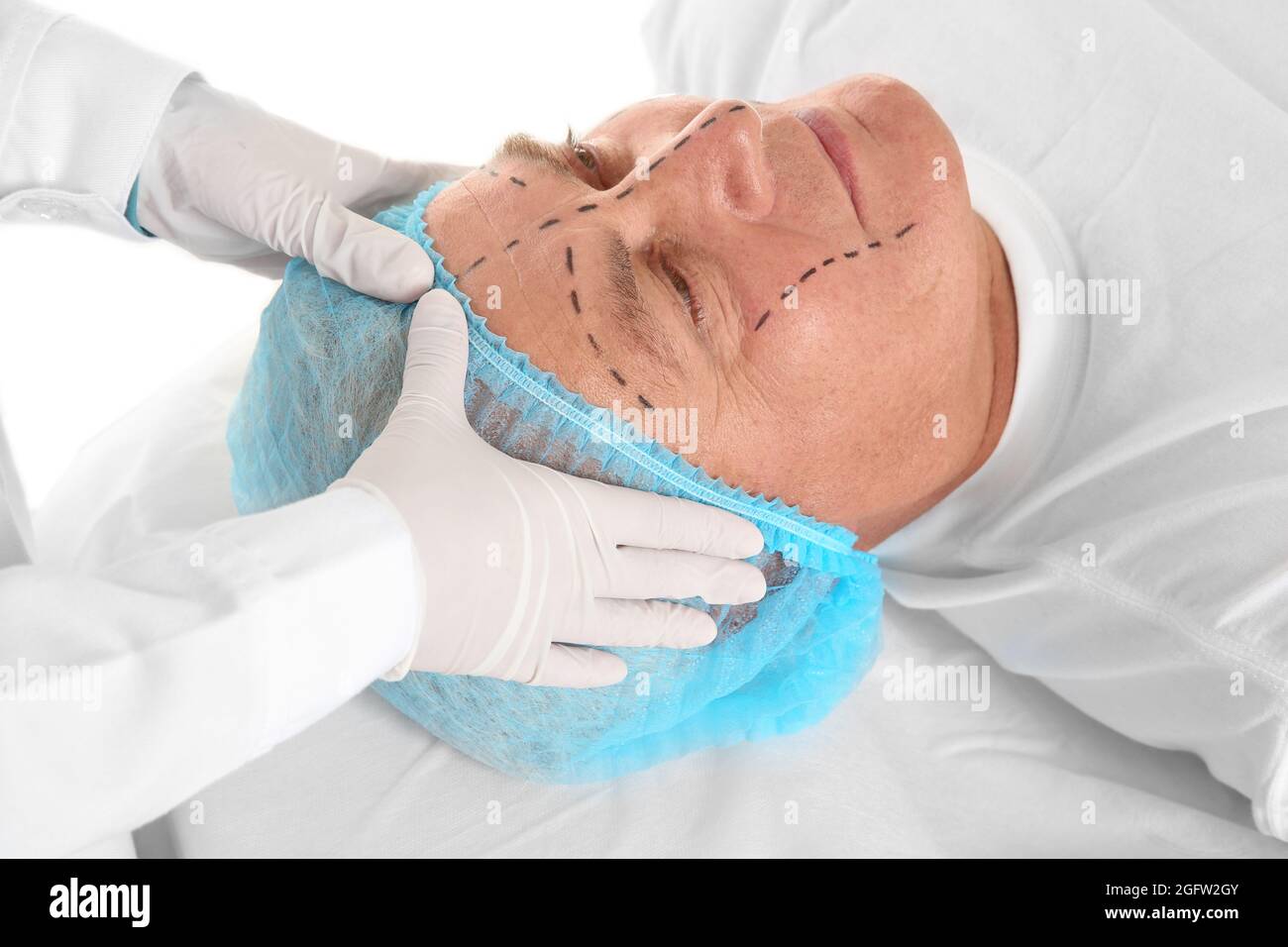 Senior man with correction line on his face at medical clinic Stock ...