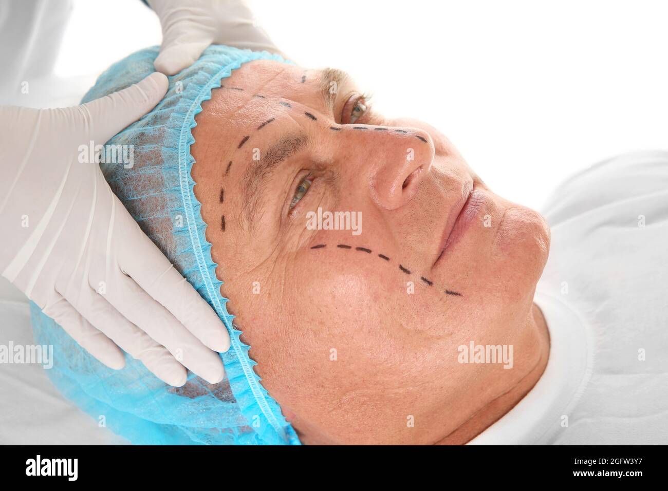 Senior man with correction line on his face at medical clinic Stock ...