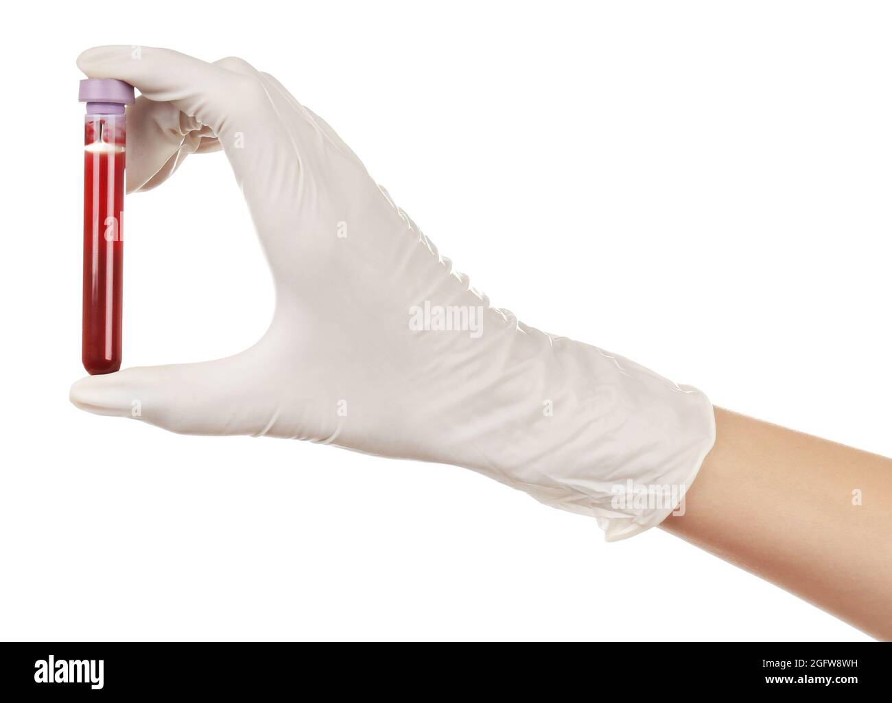 Hand holding test tube with blood isolated on white Stock Photo - Alamy