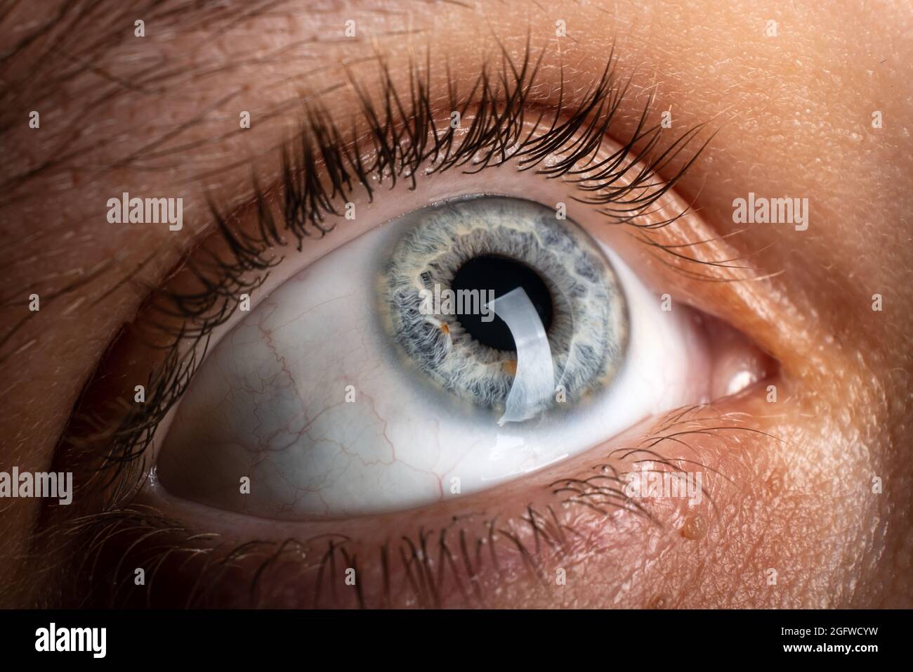 scared human eye closeup, fear symbol Stock Photo - Alamy
