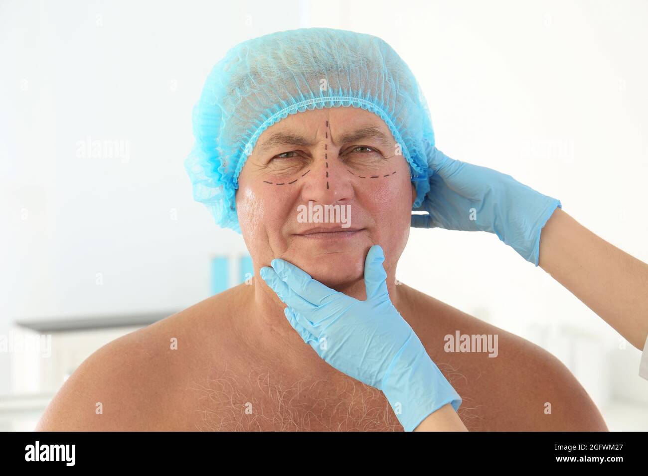 Man face surgery marks hi-res stock photography and images - Alamy