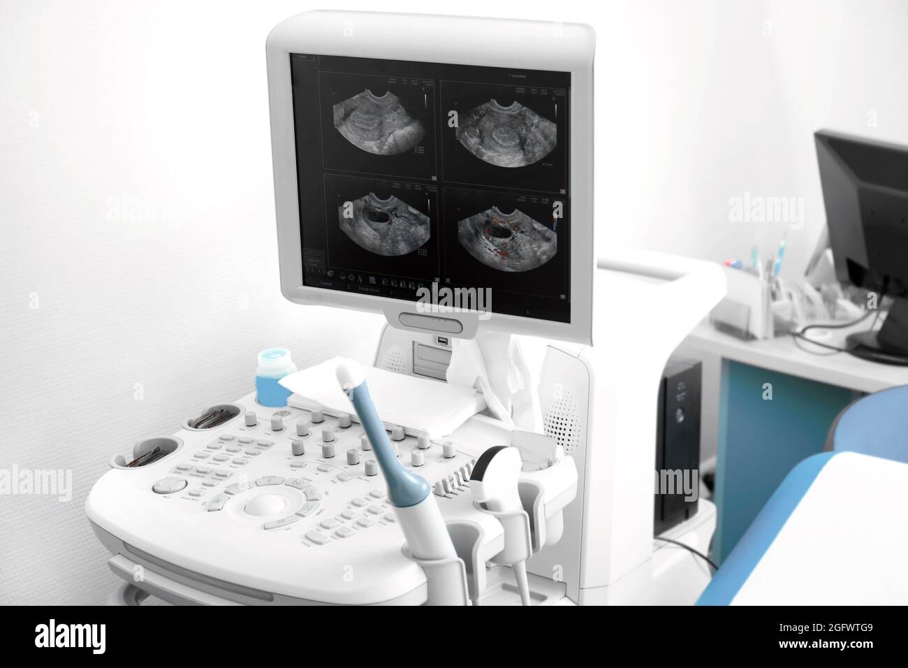 Ultrasound scan pregnancy early stage hi-res stock photography and ...