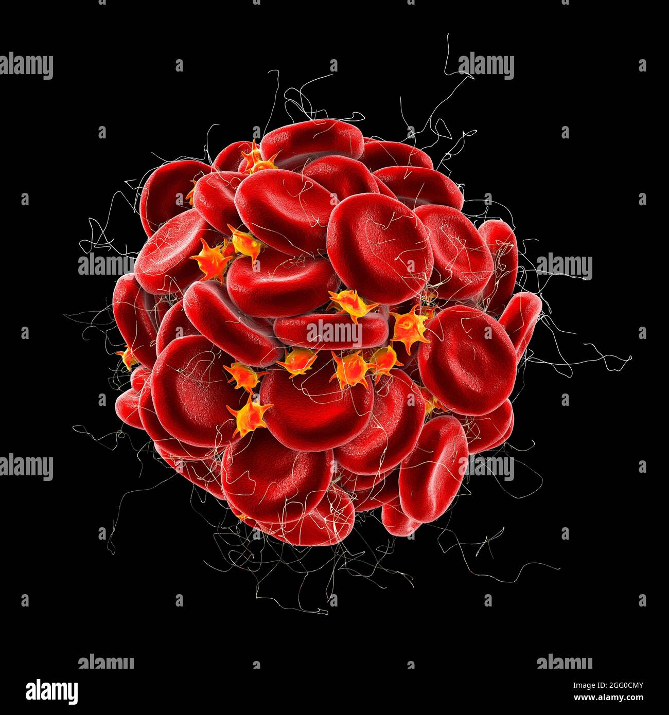 Blood clot, illustration Stock Photo - Alamy