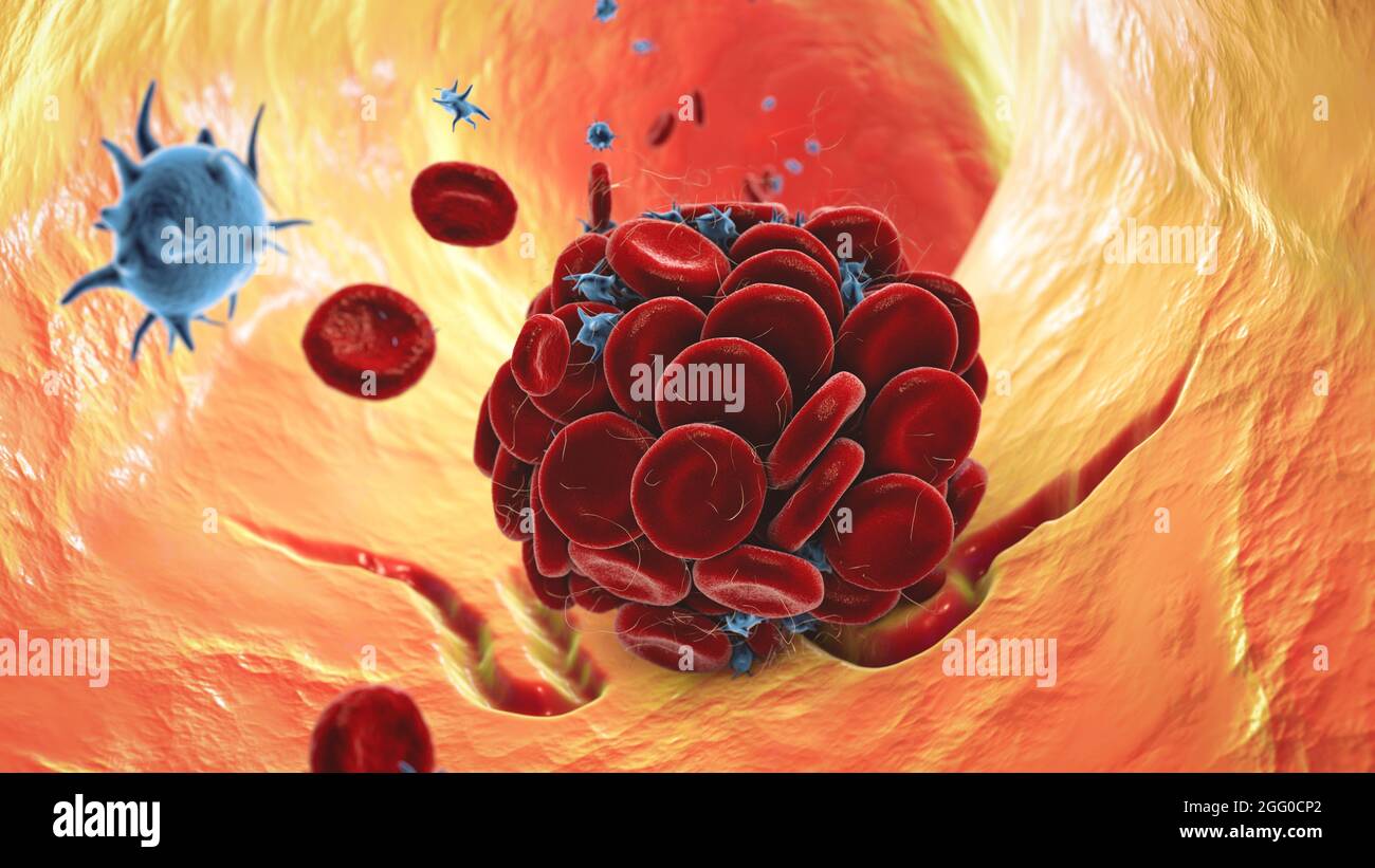 Fibrin strands hi-res stock photography and images - Alamy