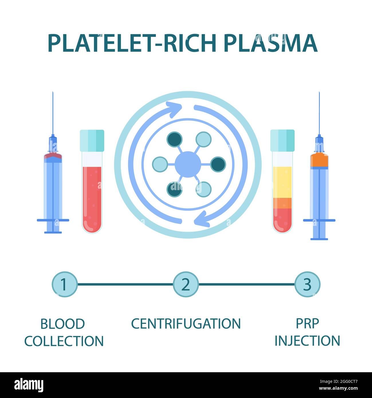Platelet-rich plasma (PRP) procedure, illustration Stock Photo - Alamy