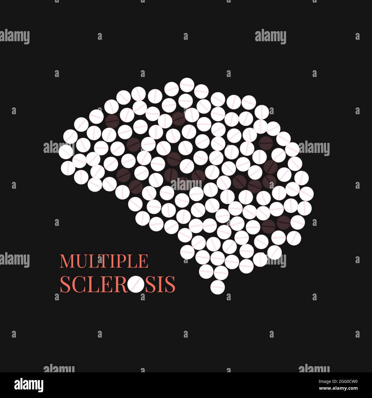 Multiple sclerosis, conceptual illustration Stock Photo - Alamy