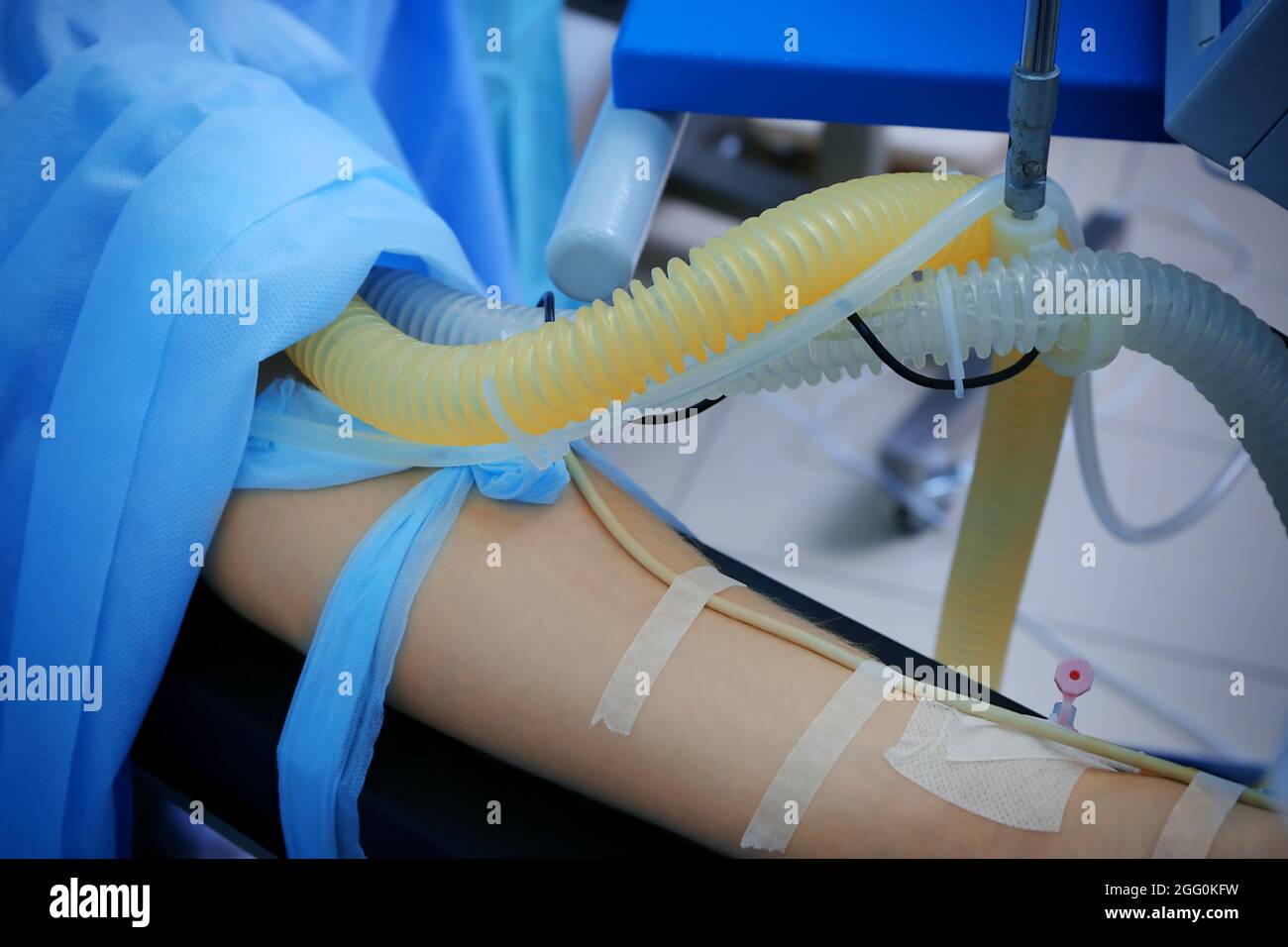 Arm of patient lying on table in operating room Stock Photo - Alamy