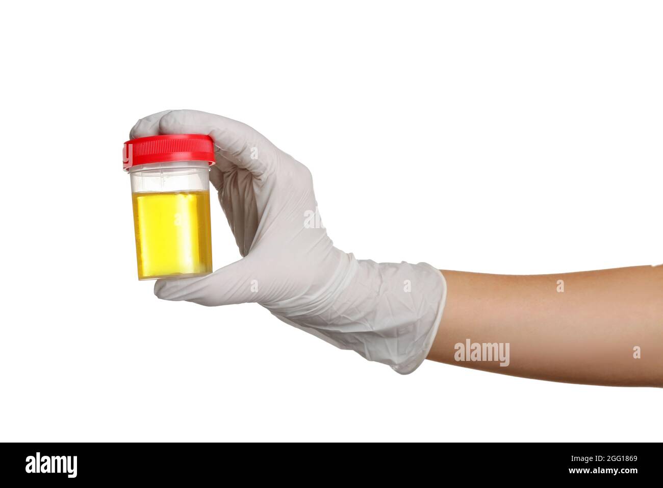 Hand in white glove holding specimen cup with urine test on white ...