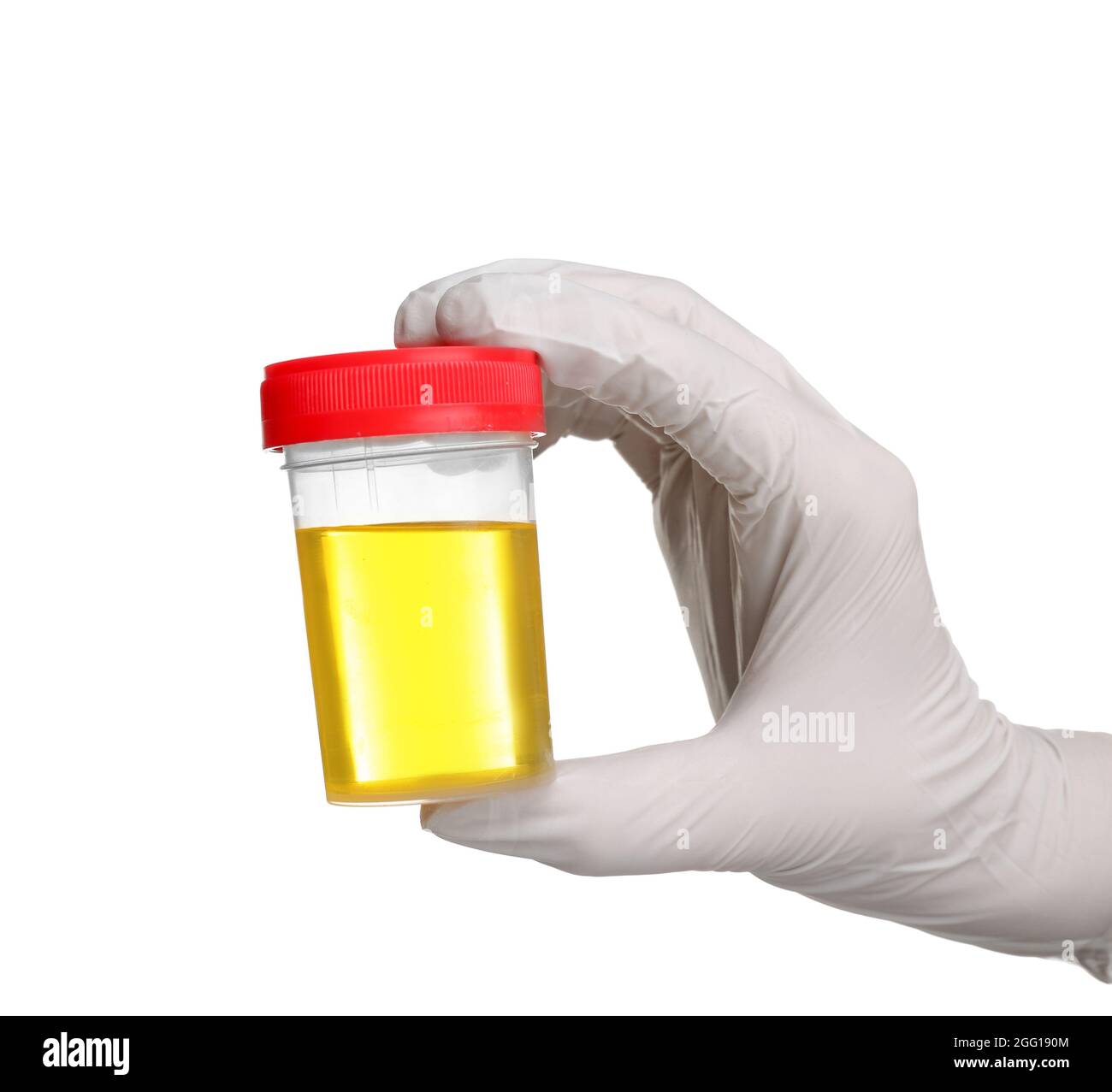 Hand in white glove holding specimen cup with urine test on white ...