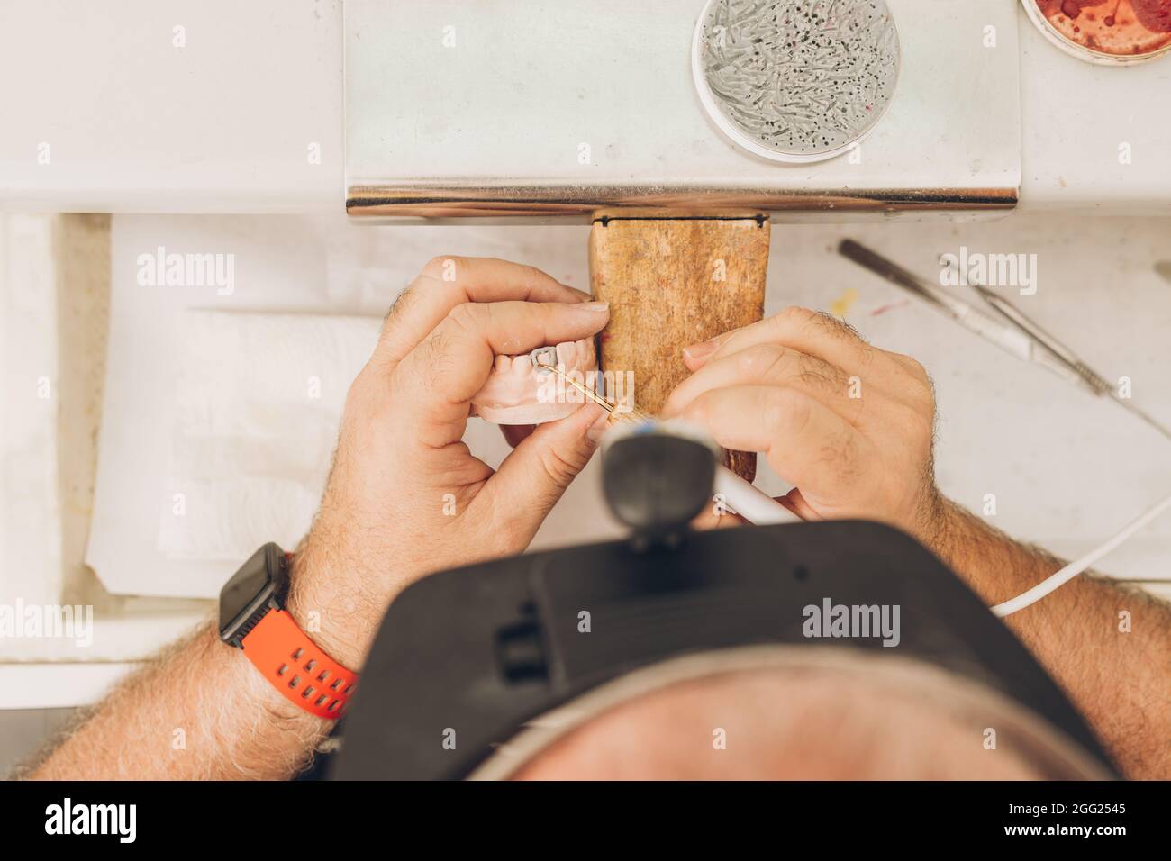 Teeth mould hi-res stock photography and images - Alamy