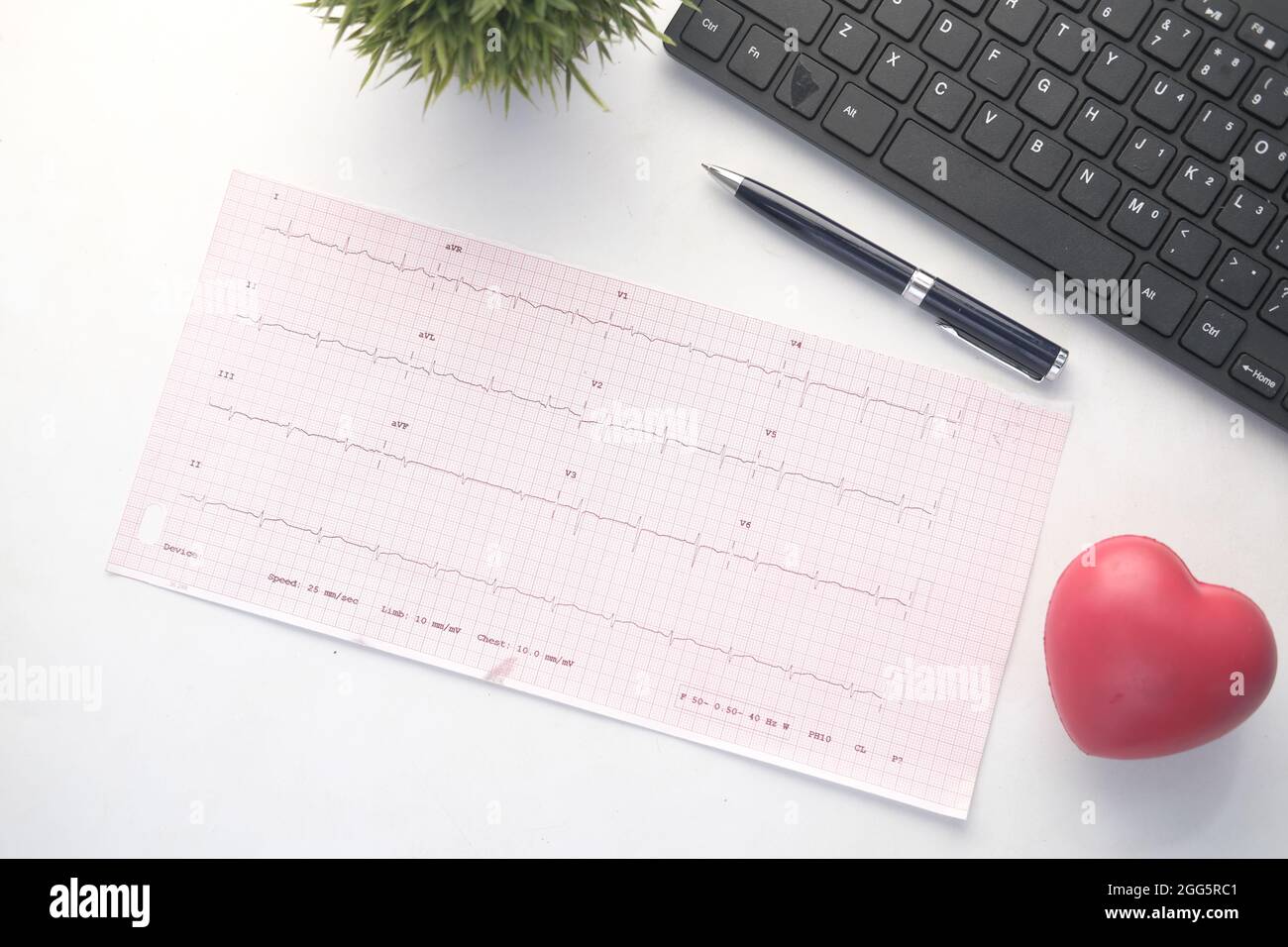 Ecg printout hi-res stock photography and images - Alamy