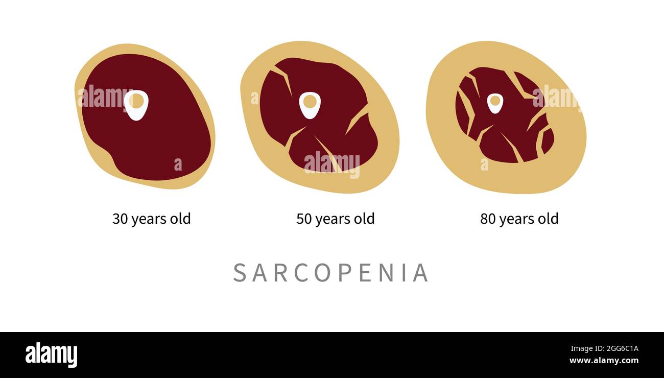 Physiological age Stock Vector Images - Alamy